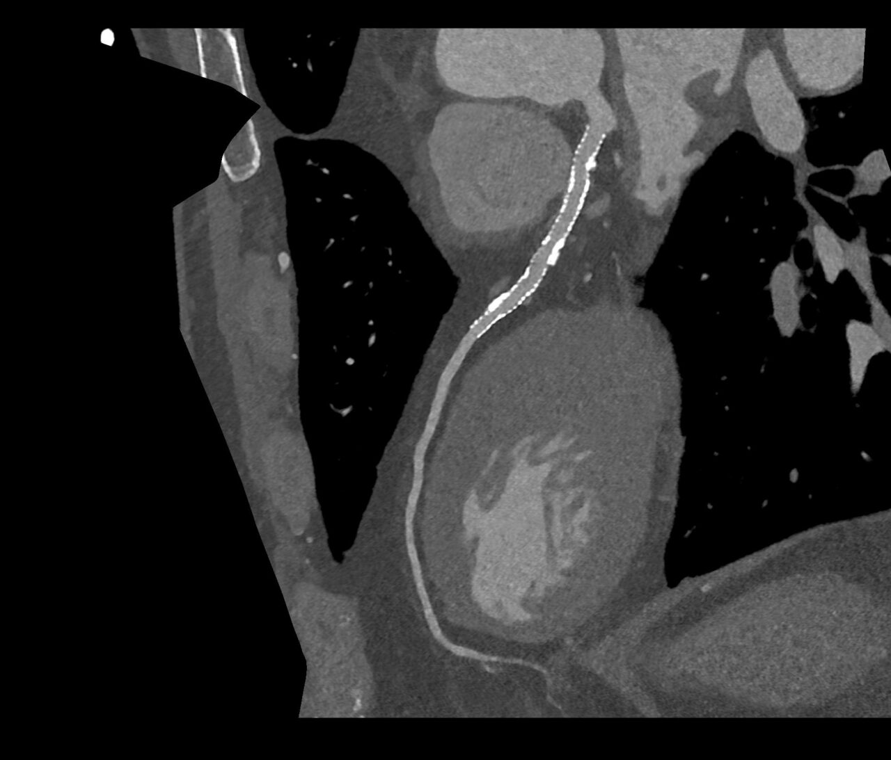 Siemens Healthineers erweitert Photon-Counting CT-Portfolio - OERG